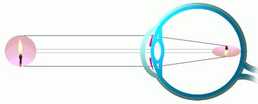 Enfermedades del Ojo